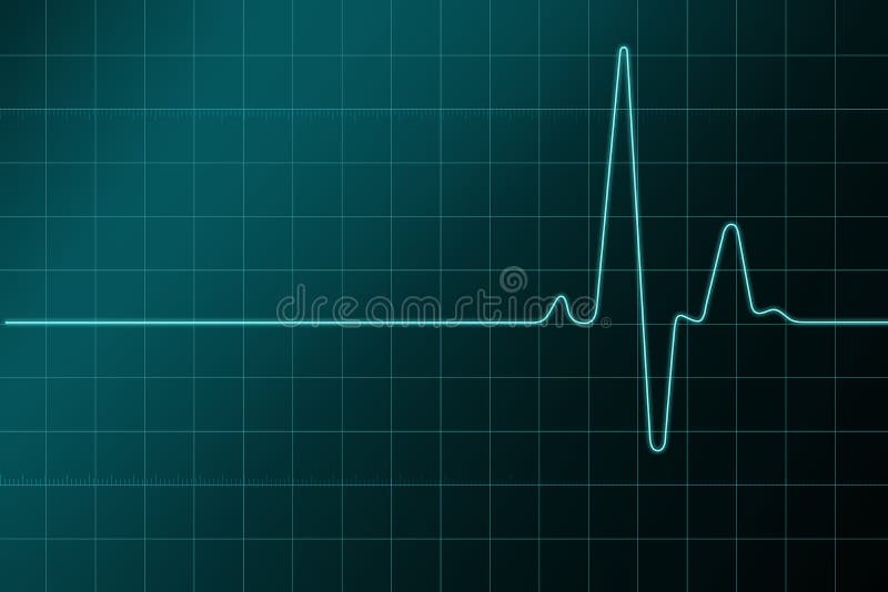 Cardiogramme illustration stock. Illustration du électrocardiogramme ...
