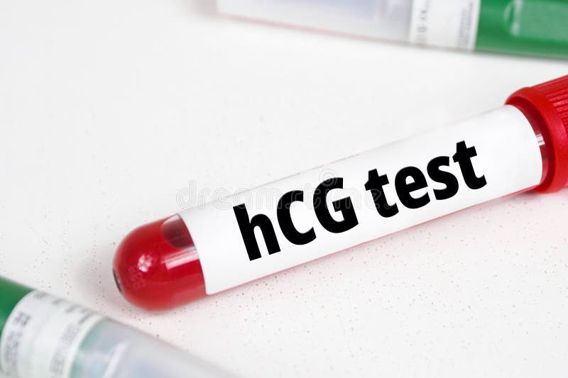 HCG Test Title Text of Medical Analysis Stock Photo - Image of ...
