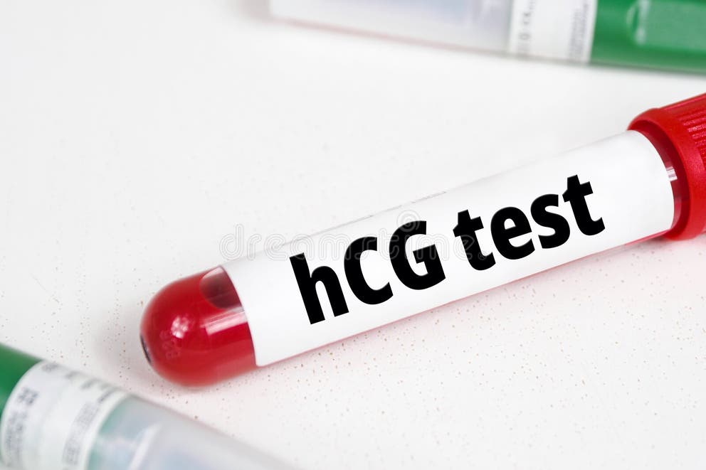 HCG Test Title Text of Medical Analysis Stock Photo - Image of ...