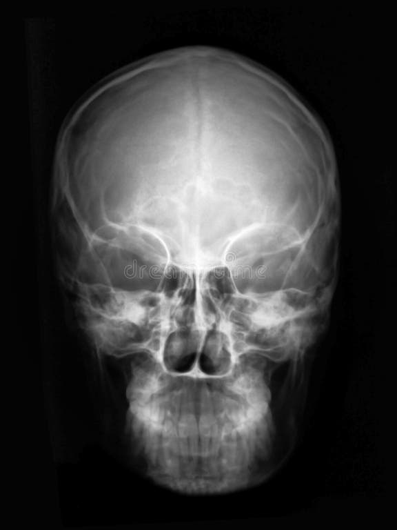 2,233 Head Radiography Stock Photos - Free & Royalty-Free Stock Photos ...