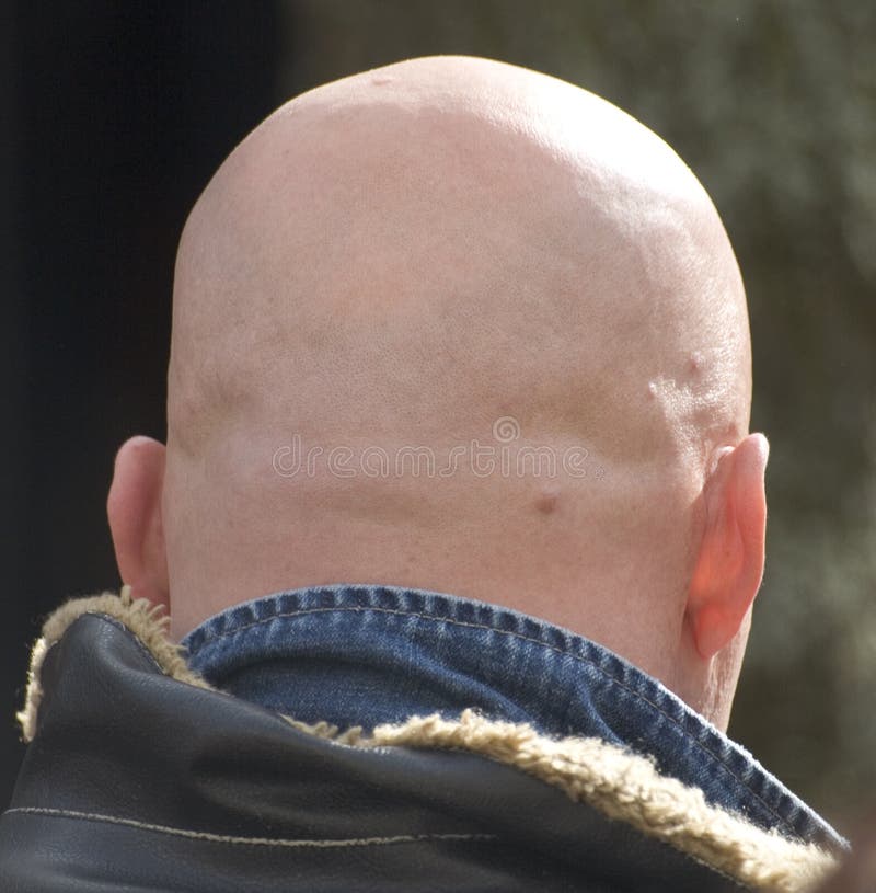 Bald man head stock photo. Image of nape, male, hairstyle - 24052906