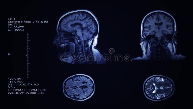 Head and Brain Computer Tomography Result Visualization. Four ...