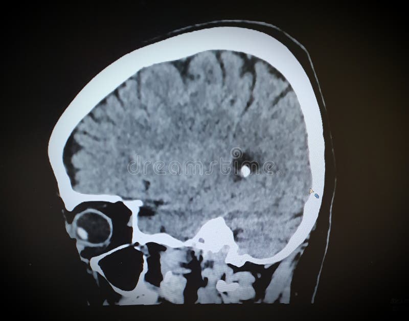 Head CT scan stock image. Image of side, native, medicine - 132611119