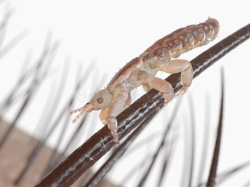 Head louse stock vector. Illustration of shaft, skin - 12907656