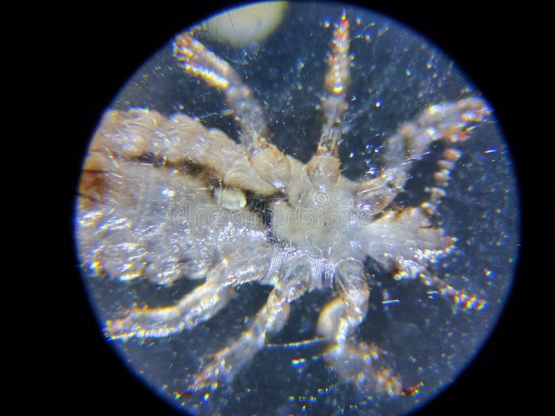 Head louse stock image. Image of microscopic, capitis - 283013837