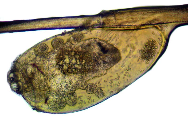 Head Louse - Pediculus Capitis, Microscope Picture Stock Photo - Image ...