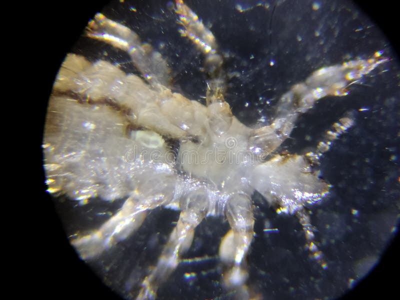 The Head Louse (Pediculus Humanus Capitis) Stock Photo - Image of ...