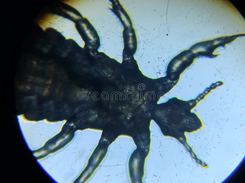 The Head Louse (Pediculus Humanus Capitis) Stock Photo - Image of ...