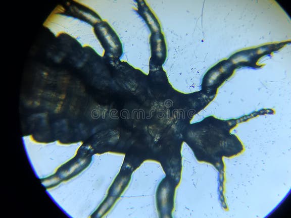 The Head Louse (Pediculus Humanus Capitis) Stock Image - Image of ...