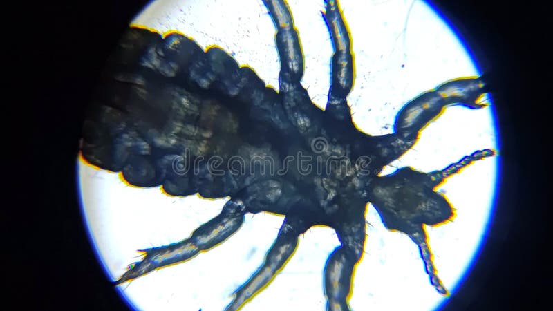 Head Louse Under Microscope Stock Photo - Image of closeup, capitis ...