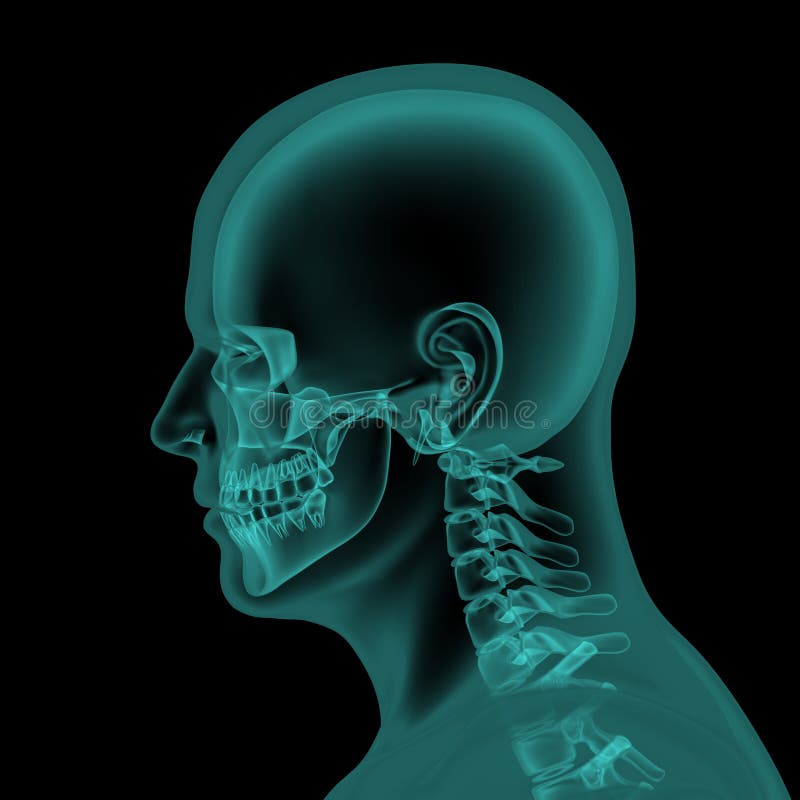 Head and neck x-ray scan stock illustration. Illustration of science ...