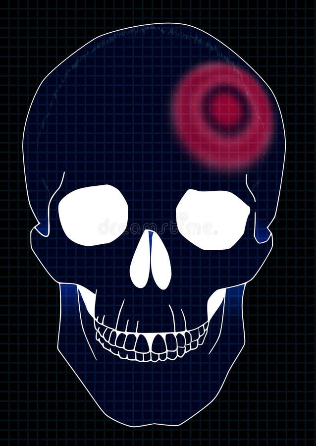 Head Trauma Picture. Image: 8541278