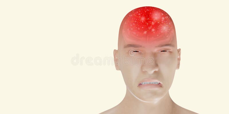Headache Brain System Problems Skull Pain Face Man Showing Headaches 3d ...