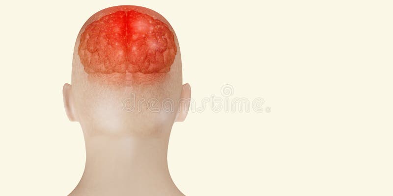 Headache Brain System Problems Skull Pain Face Man Showing Headaches 3d ...