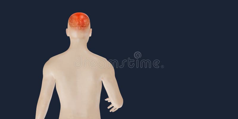 Headache Brain System Problems Skull Pain Face Man Showing Headaches 3d ...