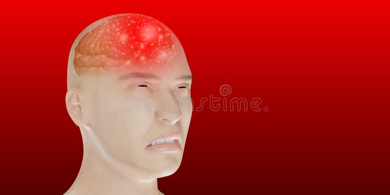 Headache Brain System Problems Skull Pain Face Man Showing Headaches 3d ...