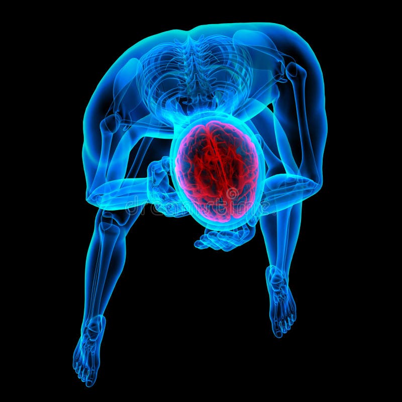 Headache stock illustration. Illustration of form, anatomical - 42345393