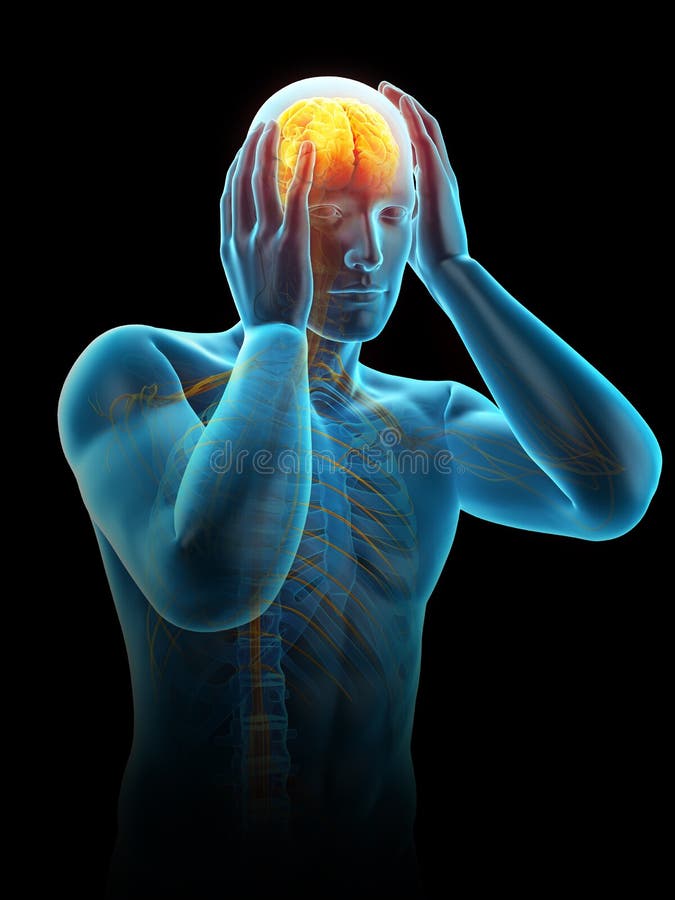 Headache / migraine stock illustration. Illustration of physiology - 8690653