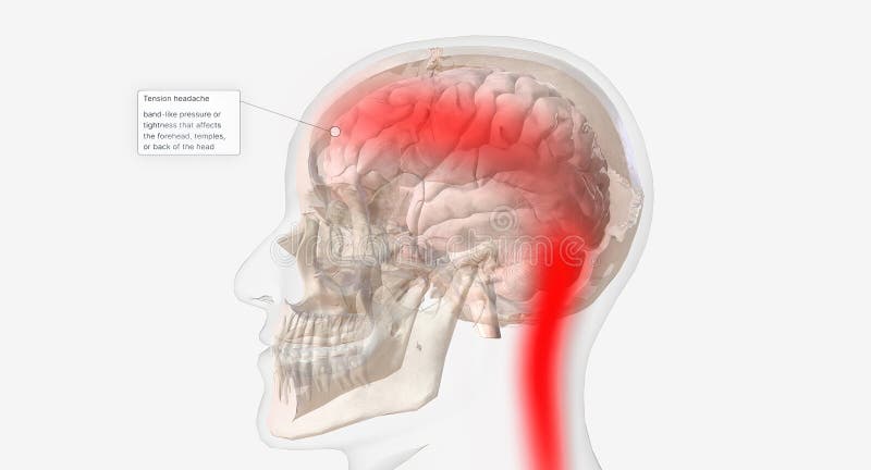 Head Temples Stock Illustrations – 204 Head Temples Stock Illustrations ...