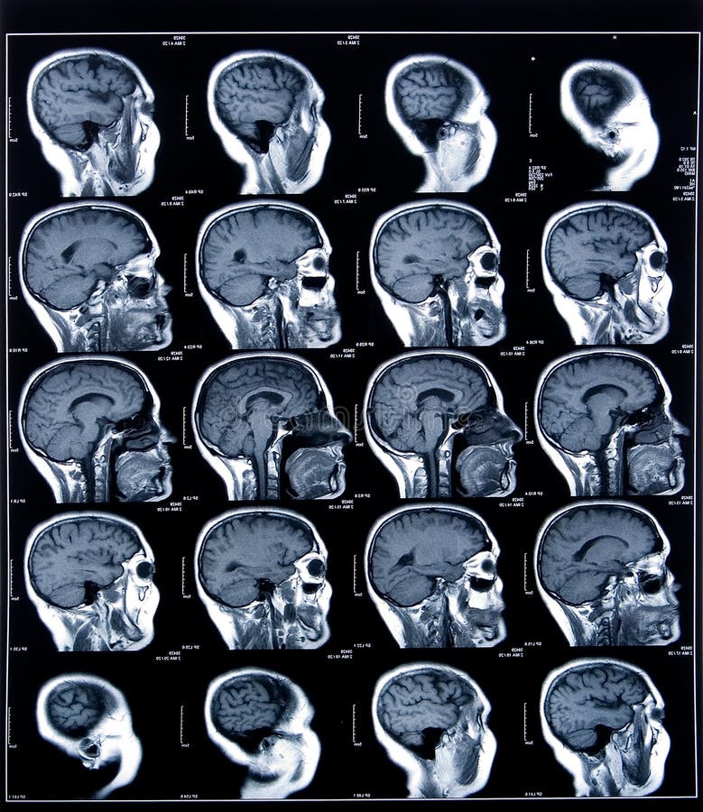 Health medical mri stock image. Image of medicine, human - 4839785