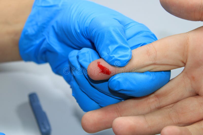Healthcare Hand Taking Blood Sample from a Finger Stock Photo - Image ...