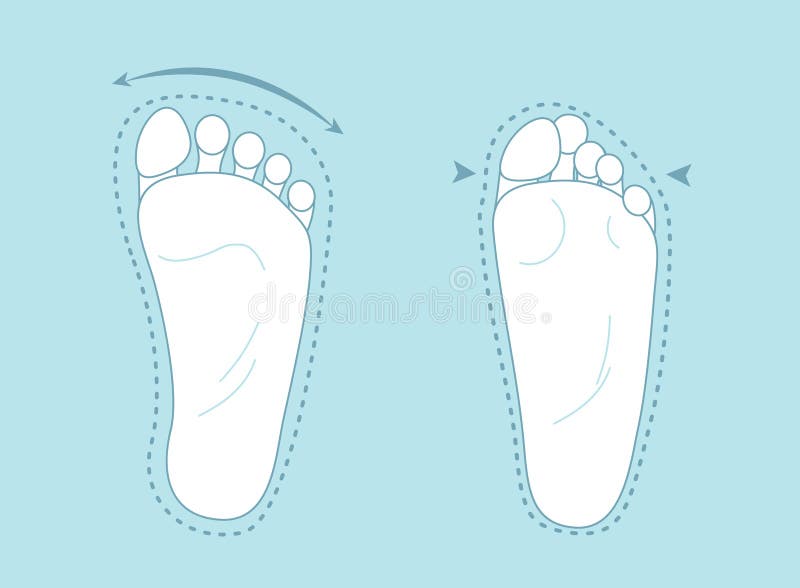 Healthy and Deformed Human Feet Comparison. Barefoot Shoes Vs Regular ...