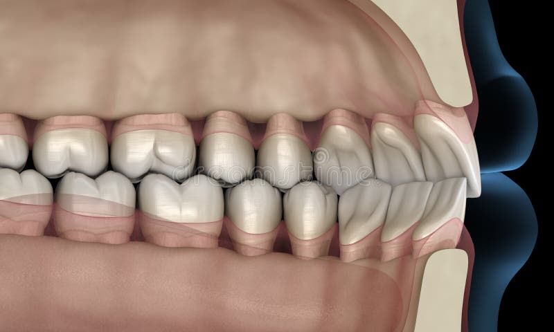 Healthy Human Teeth with Normal Occlusion, 3D Illustration Stock ...