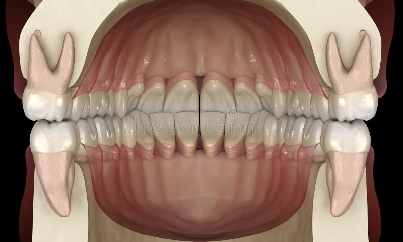 Healthy Human Teeth with Normal Occlusion, 3D Illustration Stock ...