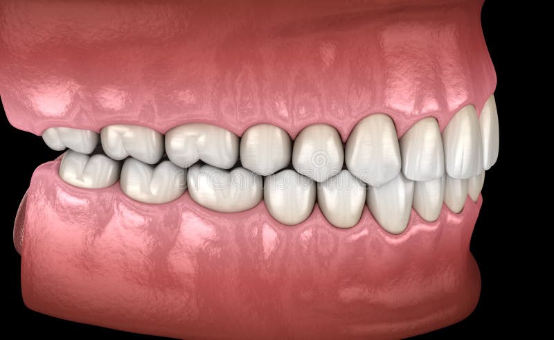 Healthy Human Teeth with Normal Occlusion. Medically Accurate Tooth 3D ...