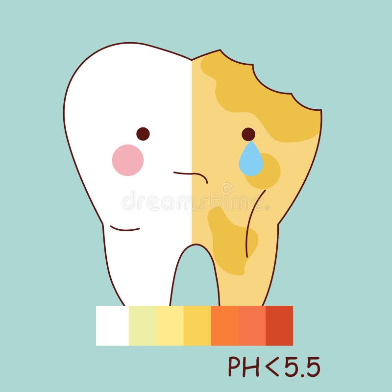 Healthy Teeth and Tooth Decay Stock Vector - Illustration of decay ...