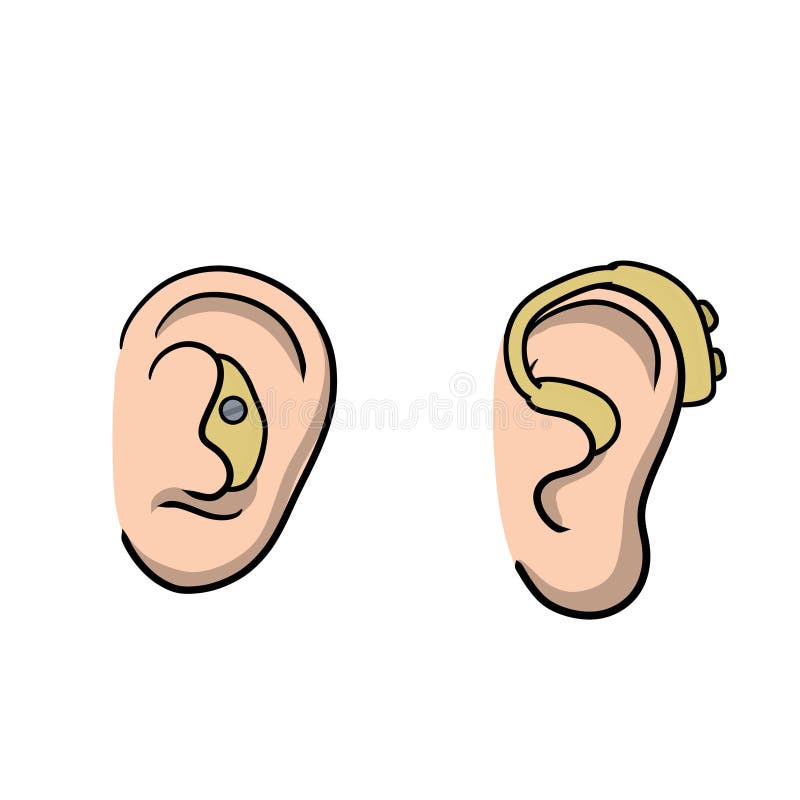 Hearing Aid. Audiphone in Ear. Set of Cartoon Illustration. Hearing ...