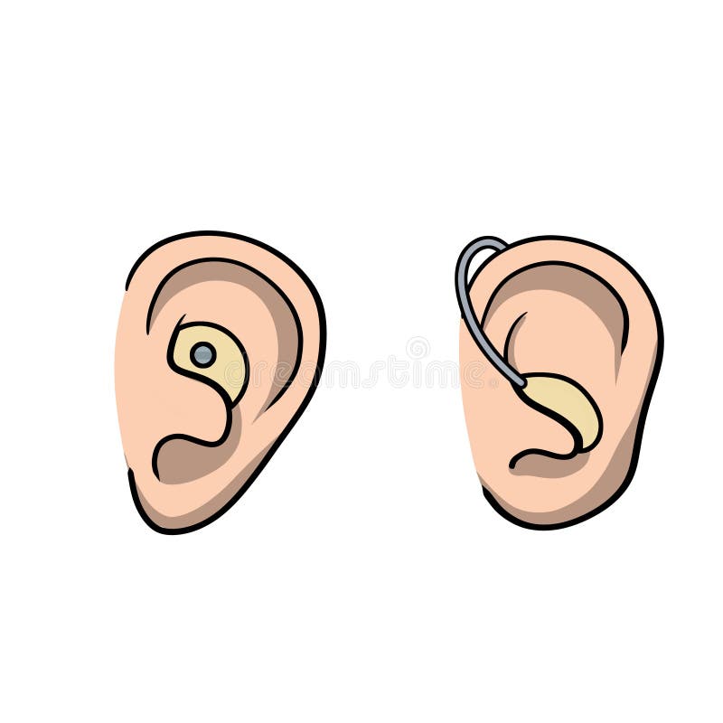 Hearing Aid Cartoon Stock Illustrations – 878 Hearing Aid Cartoon Stock ...