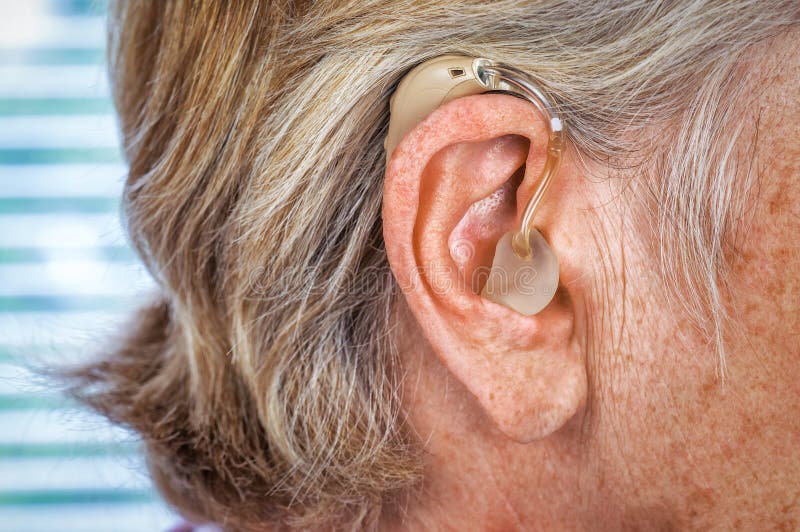 Hearing aid in the ear stock photo. Image of human, audiology - 265435060