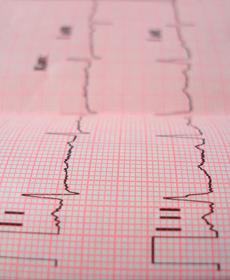 Ekg Grid Background Stock Photos - Free & Royalty-Free Stock Photos ...