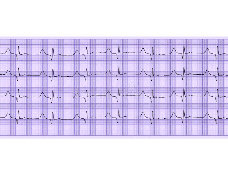 Heart Analysis, Electrocardiogram Graph Stock Image - Image of test ...