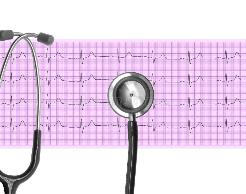 Heart Analysis, Electrocardiogram Graph (ECG) Stock Photo - Image of ...