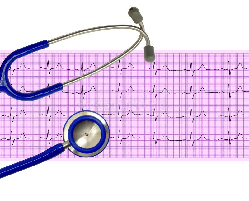 Heart Analysis, Electrocardiogram Graph (ECG) and Stethoscope Stock ...
