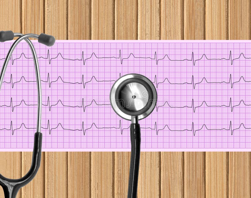 Heart Analysis, Electrocardiogram Graph (ECG) and Stethoscope on Stock ...
