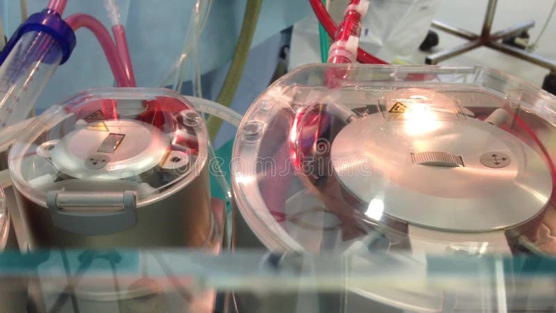 Heart Lung Machine Top View on Roller Pump of Heart Lung Machine during ...