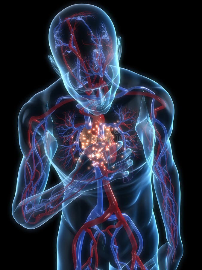 Heart attack stock illustration. Illustration of hospital - 8857527