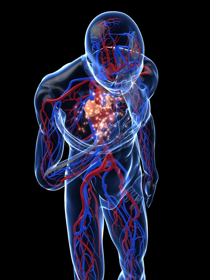 Heart attack stock illustration. Illustration of hospital - 8857597