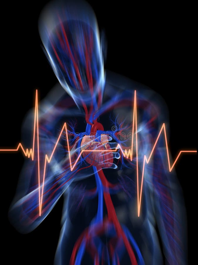 Heart attack stock illustration. Illustration of healthcare - 8857749