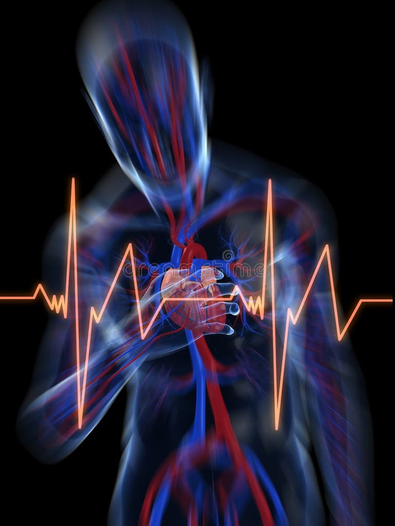 Heart Defect Stock Illustrations – 704 Heart Defect Stock Illustrations ...