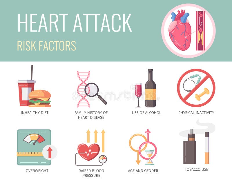 Heart Attack Infographics stock illustration. Illustration of blood ...