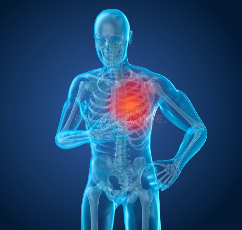 Sore Heart Stock Illustrations – 868 Sore Heart Stock Illustrations ...