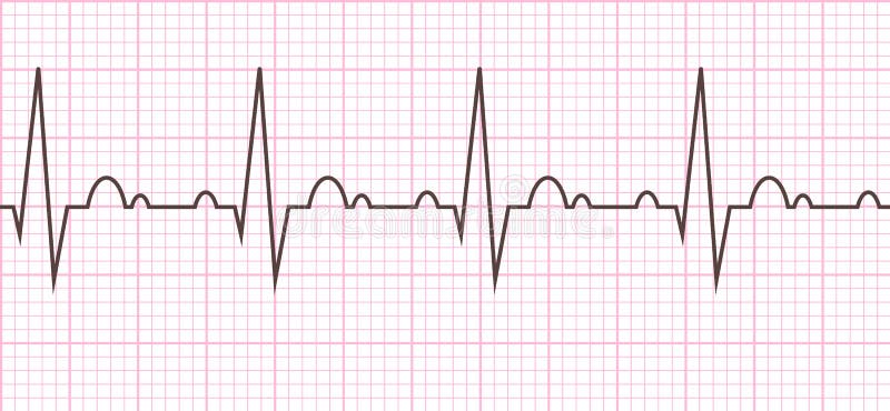 Heartbeat Normal ECG graph stock illustration. Illustration of muscular ...