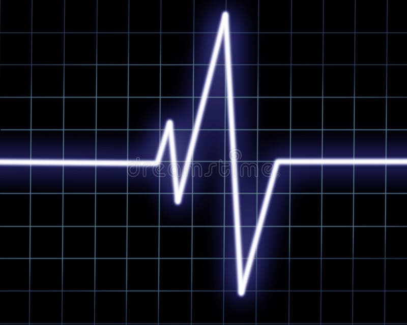 Heart beat on monitor stock illustration. Illustration of beat - 3293117