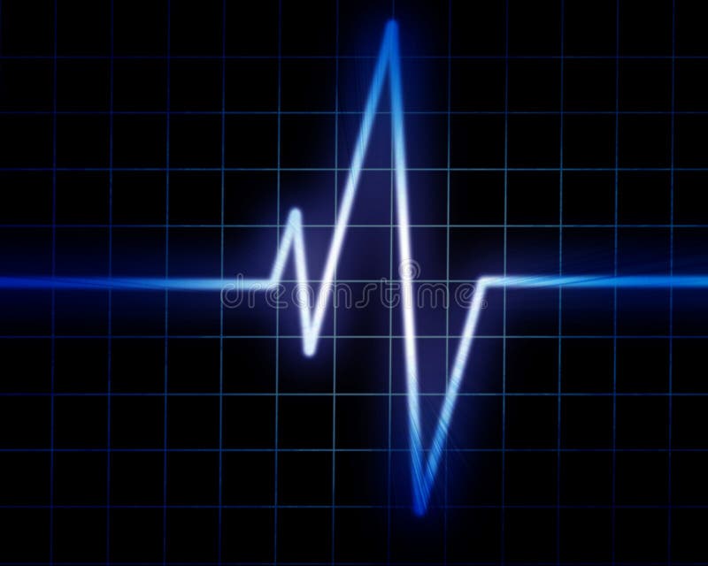 Beat Heart Monitor Stock Illustrations – 19,987 Beat Heart Monitor ... Beat Heart Monitor Stock Illustrations – 19,987 Beat Heart Monitor ...