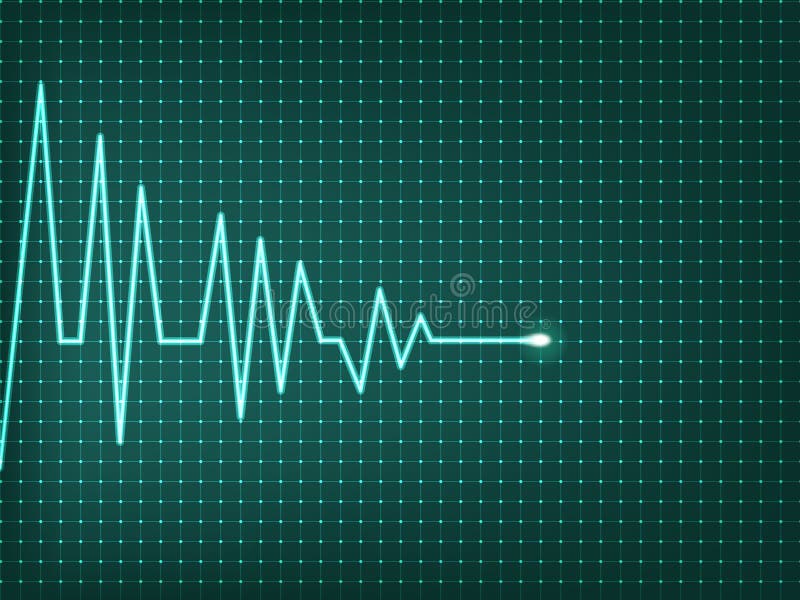 ECG Pulse Heartbeat Blue Line Stock Illustration - Illustration of ...