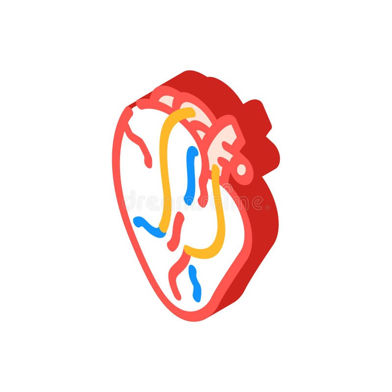 Heart Bypass Surgery Isometric Icon Vector Illustration Stock ...